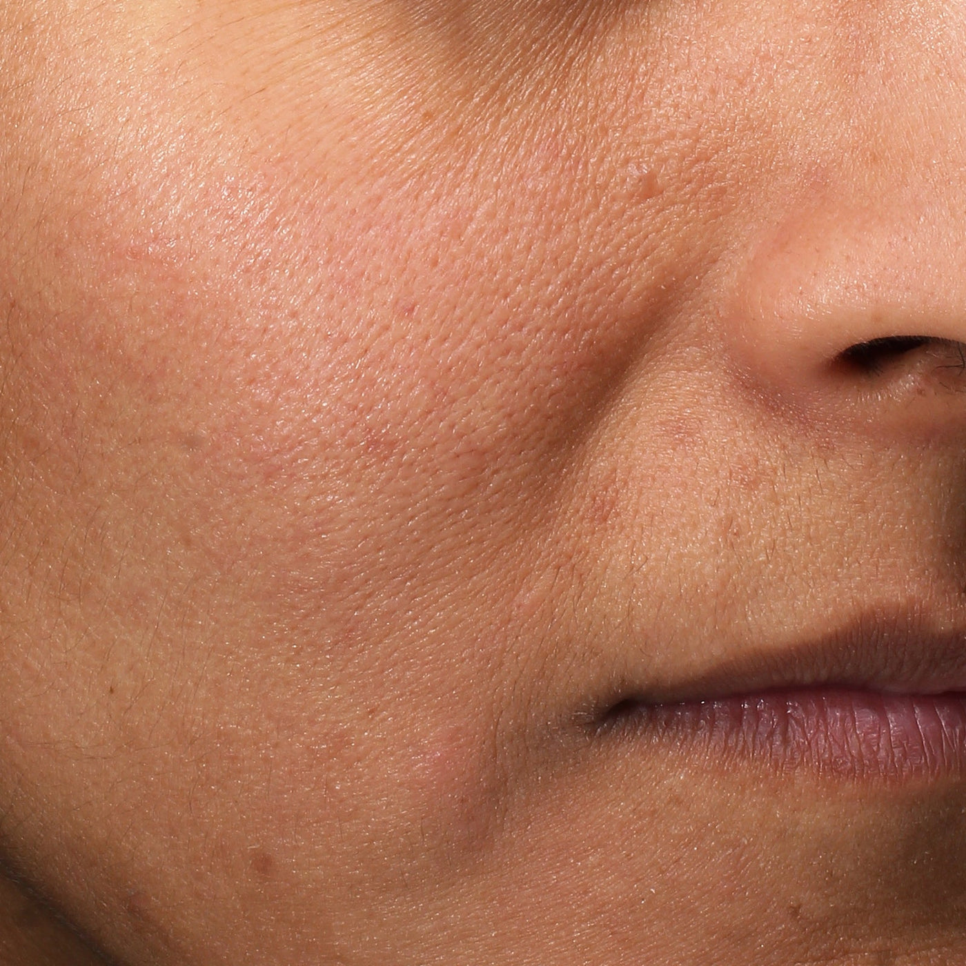 Multi Peptides & Growth Factors (GF) Advanced Lifting Serum